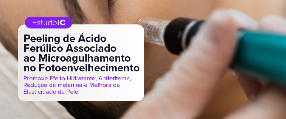 Peeling de Ácido Ferúlico Associado ao Microagulhamento no ...